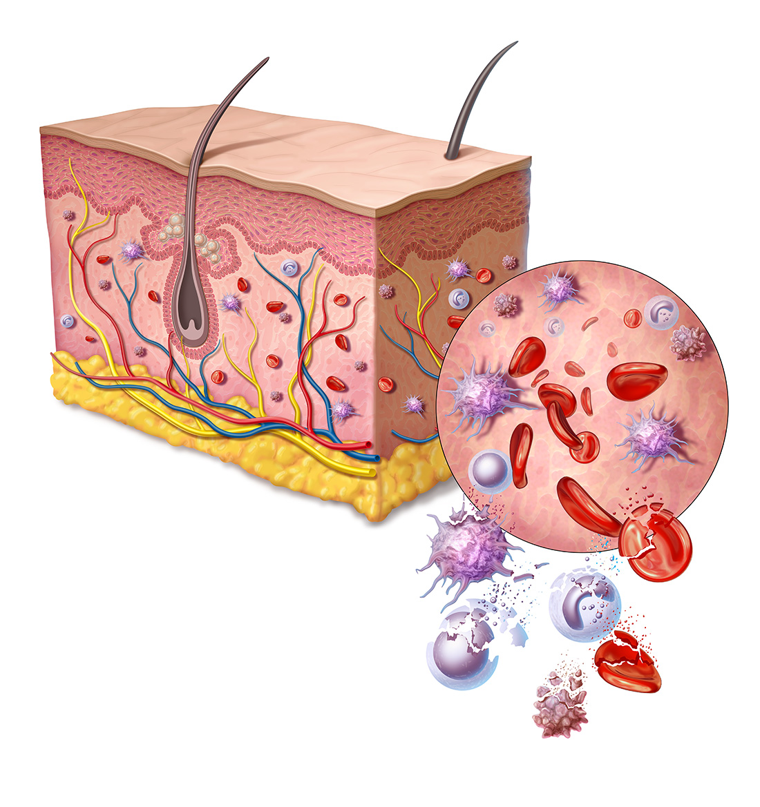 Difference - Cortiva
